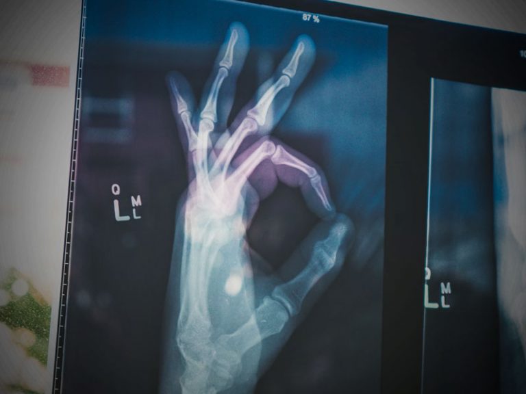 Maintaining Bone Health: A Guide to Checking Your Bone Density - Nirog ...